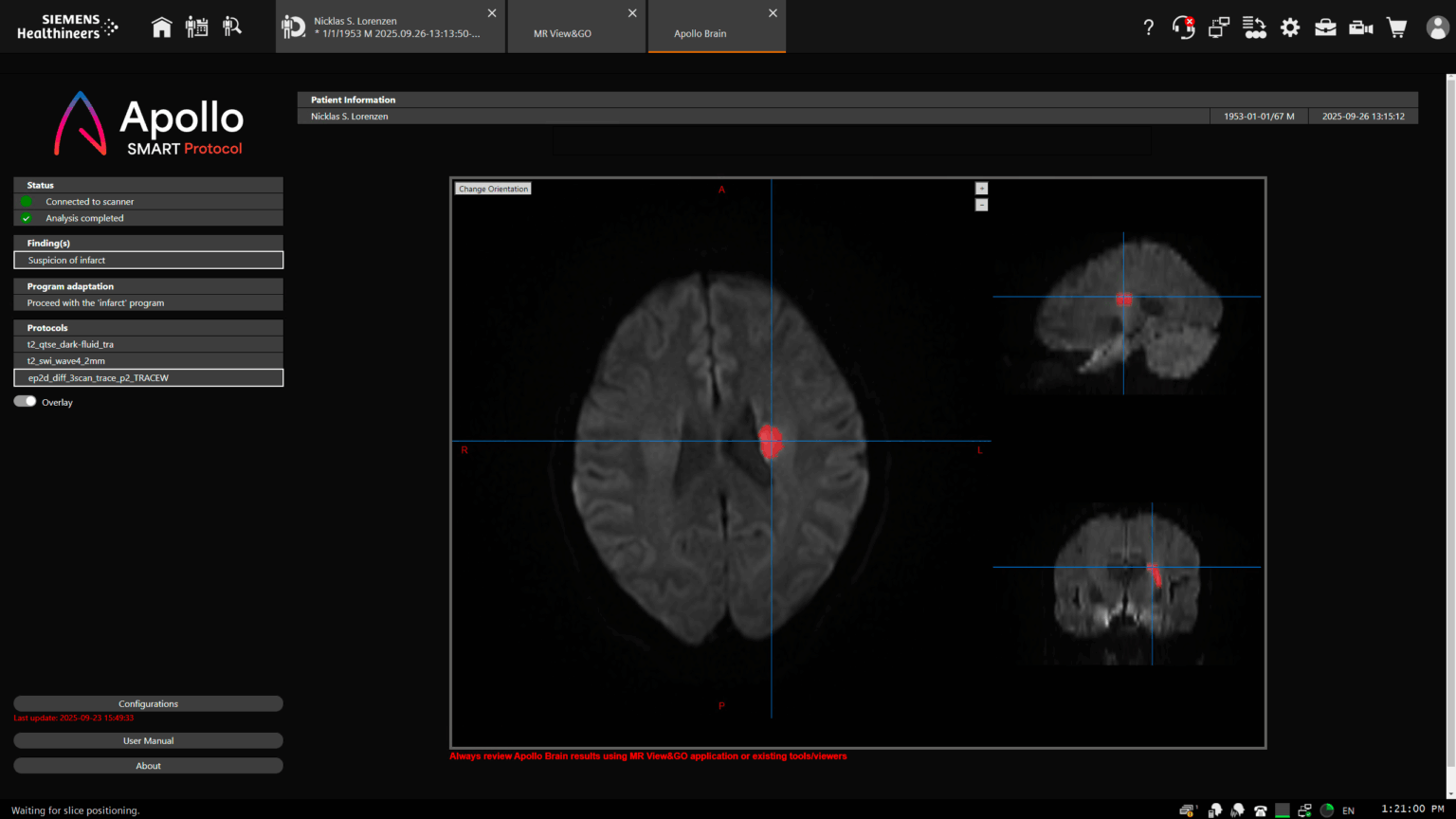 Apollo Smart Protocol for Siemens Healthineers MRI - Cerebriu